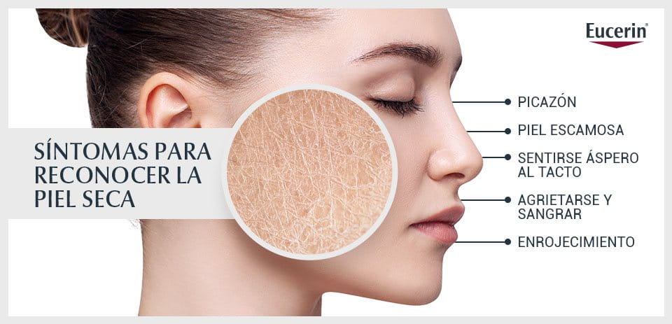 Piel sensible y seca: causas y tips para cuidarla | Eucerin®